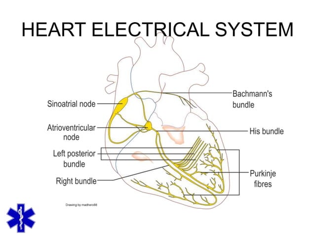 PREVIEW OF EMT/EMR CARDIOVASCULAR EMERGENCIES LESsON | PPTX