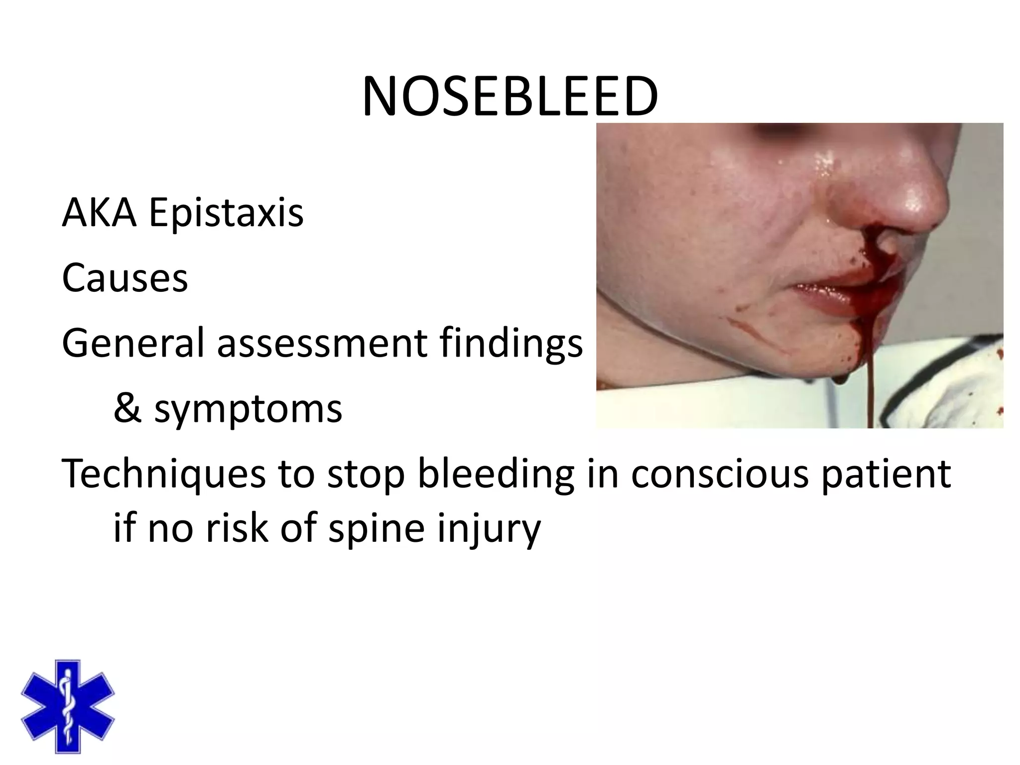 PREVIEW OF EMT/EMR BLEEDING POWERPOINT TRAINING PRESENTATION | PPTX
