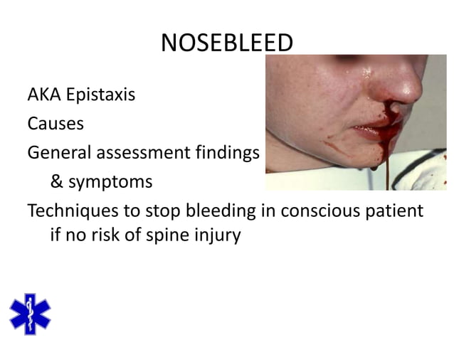 PREVIEW OF EMT/EMR BLEEDING POWERPOINT TRAINING PRESENTATION | PPT