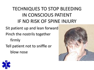 PREVIEW OF EMT/EMR BLEEDING POWERPOINT TRAINING PRESENTATION | PPTX