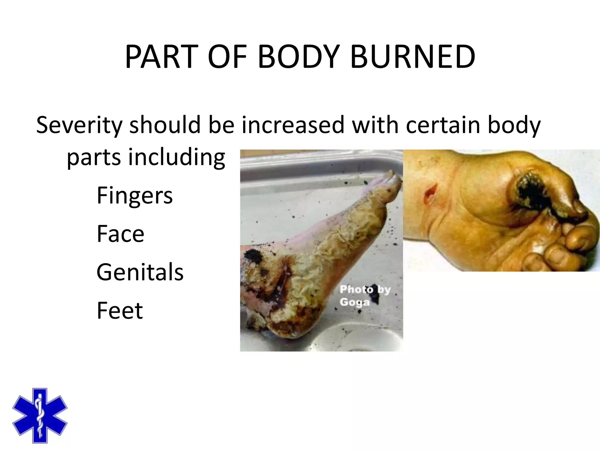 PREIEW OF EMT/EMR SOFT TISSUE POWERPOINT TRAINING PRESENTATION | PPTX