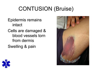 PREIEW OF EMT/EMR SOFT TISSUE POWERPOINT TRAINING PRESENTATION | PPTX