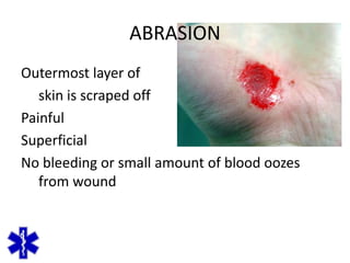 PREIEW OF EMT/EMR SOFT TISSUE POWERPOINT TRAINING PRESENTATION | PPTX ...