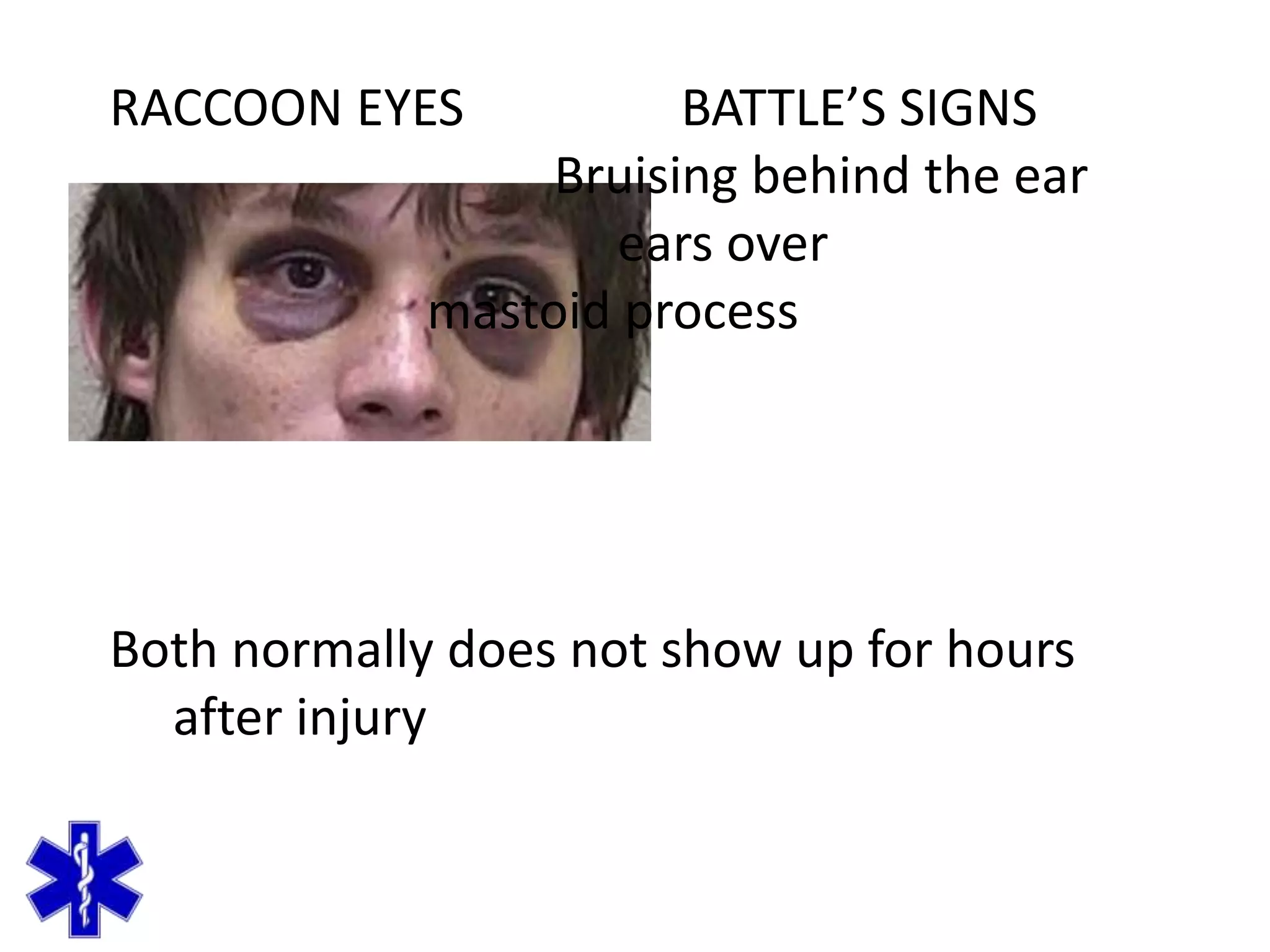 PREVIEW OF EMT/EMT NERVOUS SYSTEM TRAUMA POWERPOINT TRAINING ...