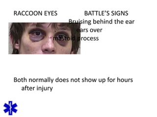 PREVIEW OF EMT/EMT NERVOUS SYSTEM TRAUMA POWERPOINT TRAINING ...