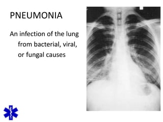 PREVIEW OF EMT/EMR GERIATRIC EMERGENCIES POWERPOINT TRAINING ...