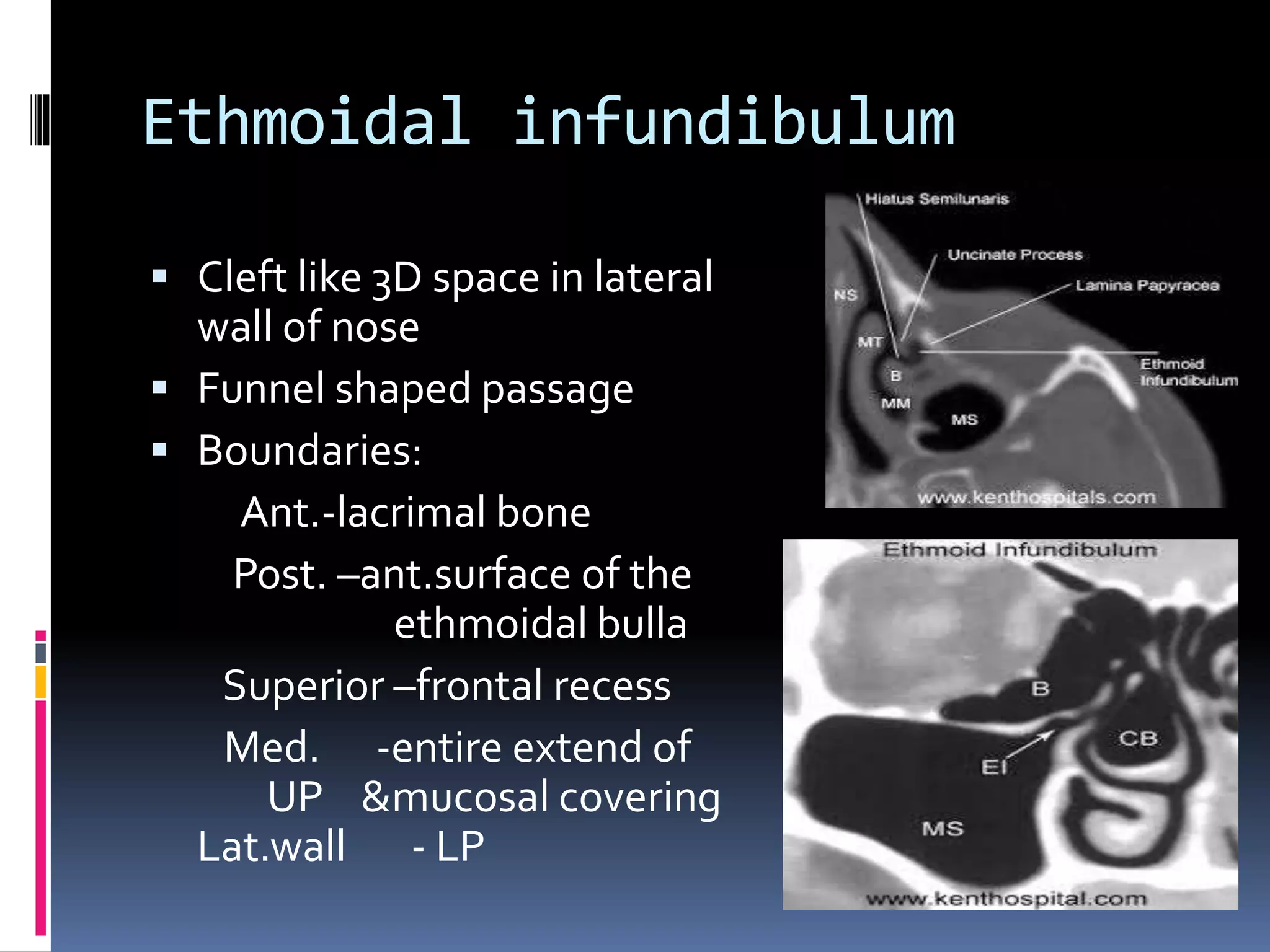 endoscopic anatomy of nasal cavity | PPTX