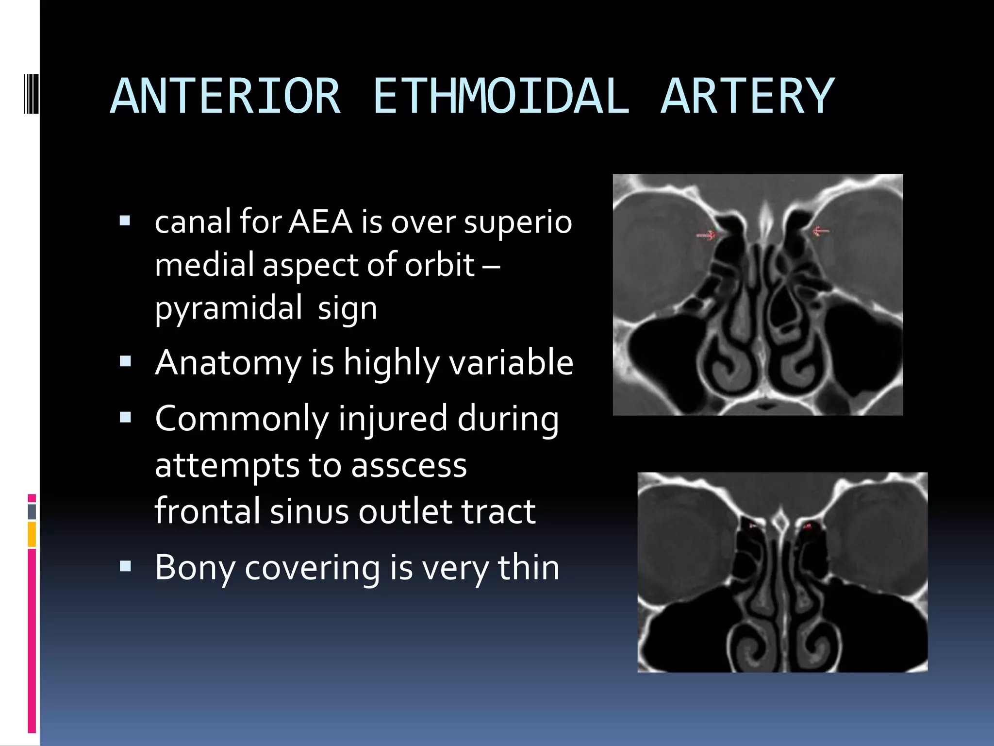 endoscopic anatomy of nasal cavity | PPTX