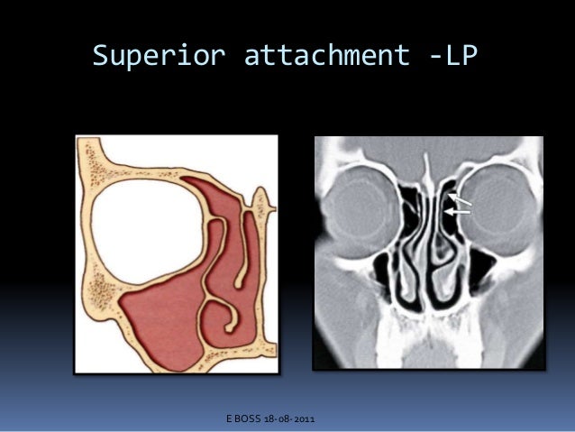 endoscopic anatomy of nasal cavity