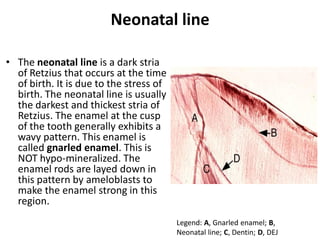 Neonatal Line