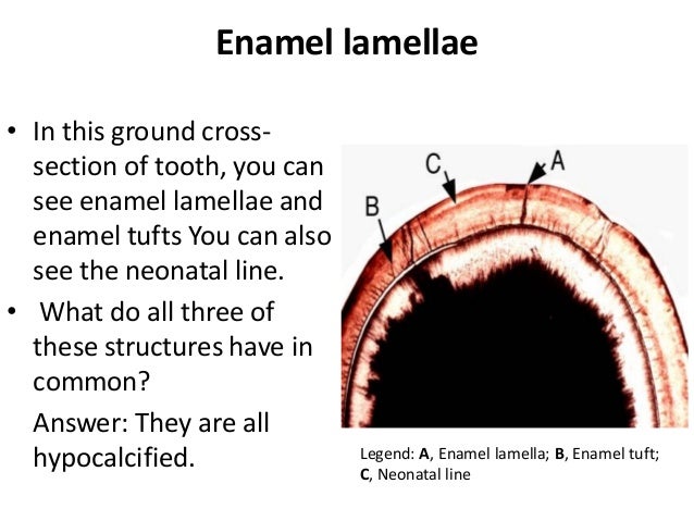 Enamel