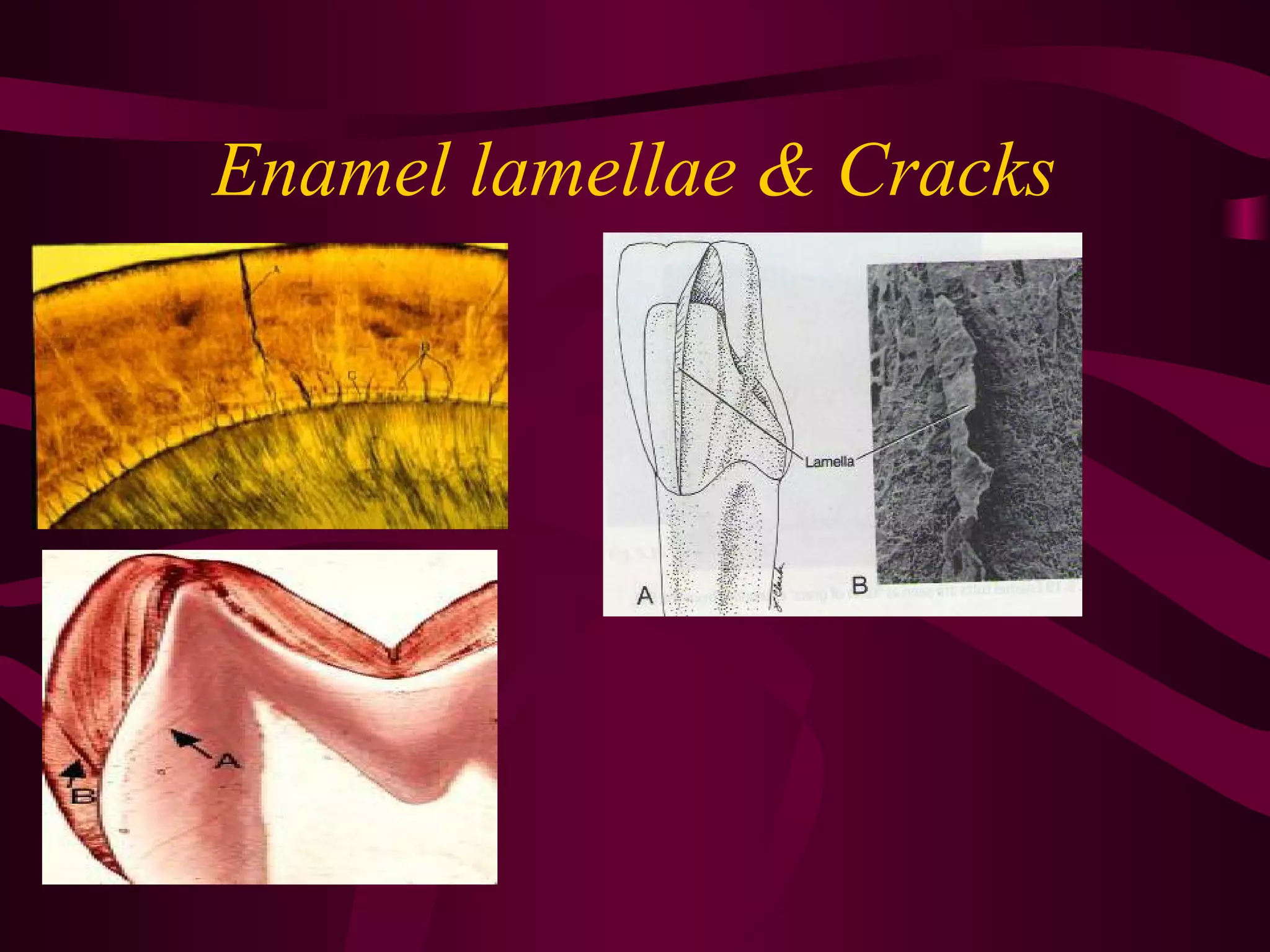 Histology of Enamel | PPT