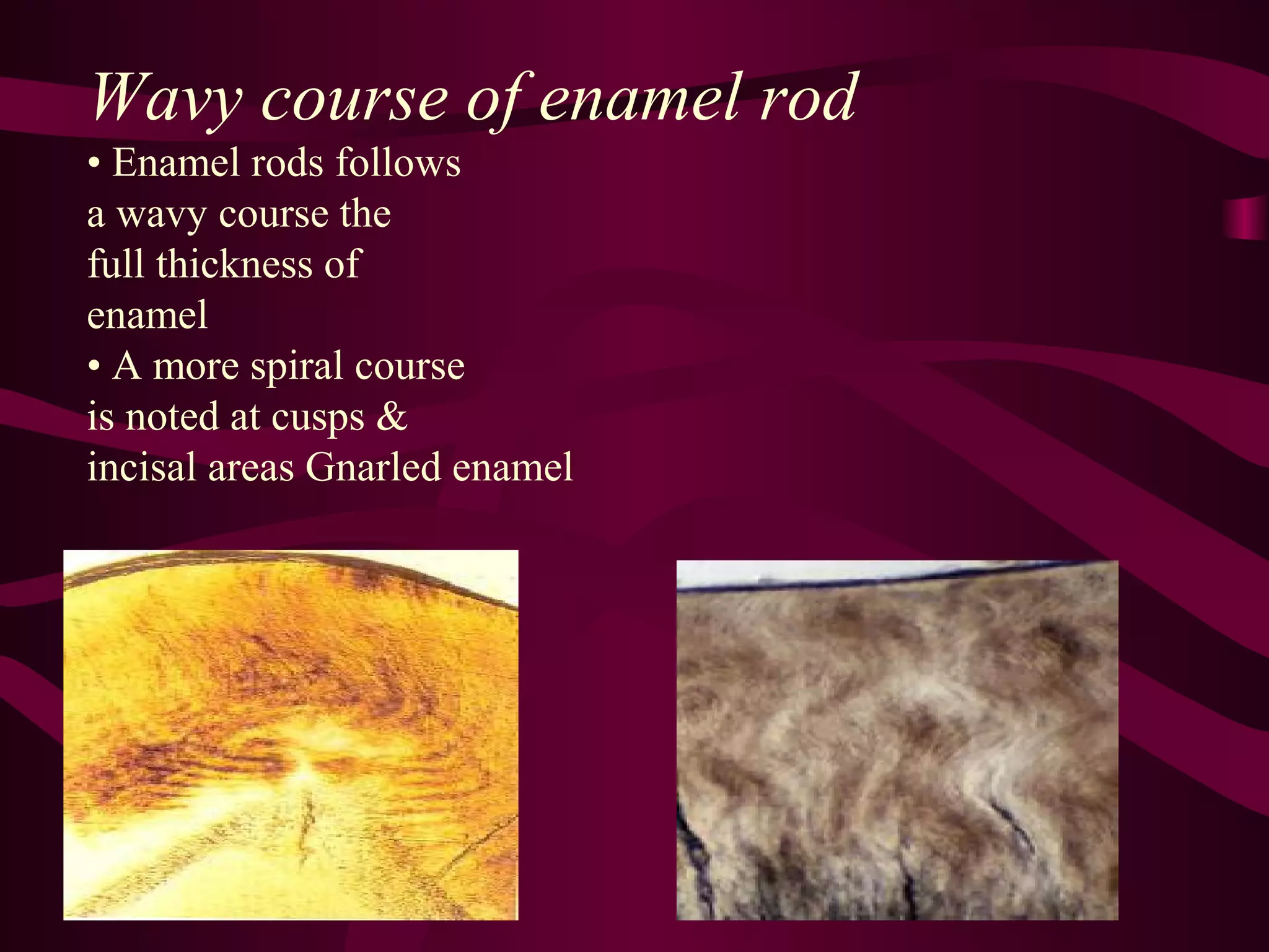 Histology of Enamel | PPT
