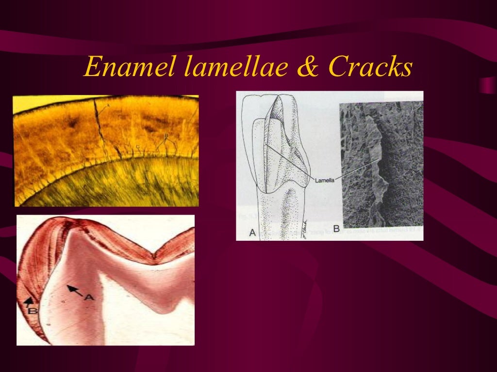 Histology of Enamel