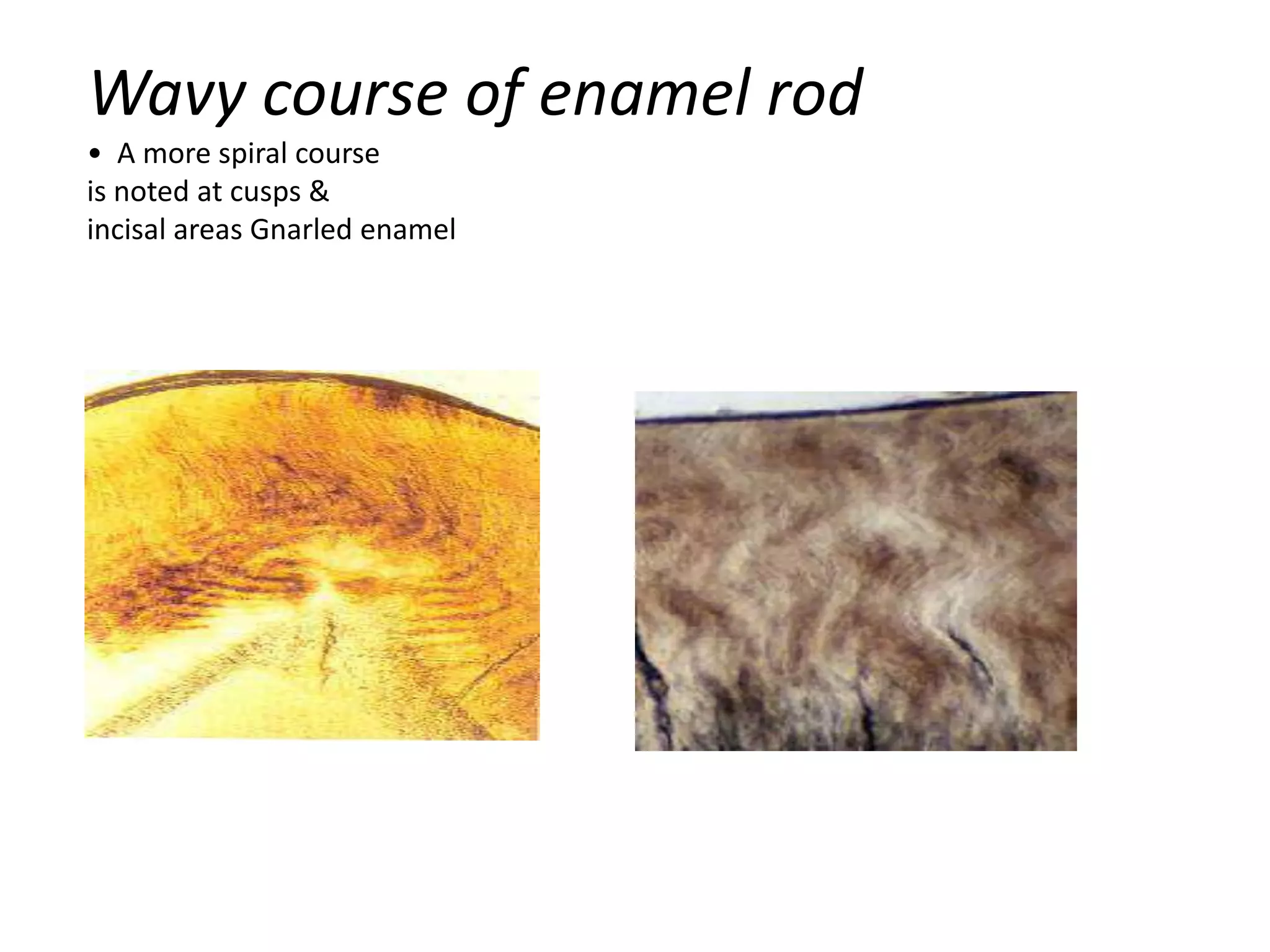 Enamel | PPTX | Dental Health | Diseases and Conditions