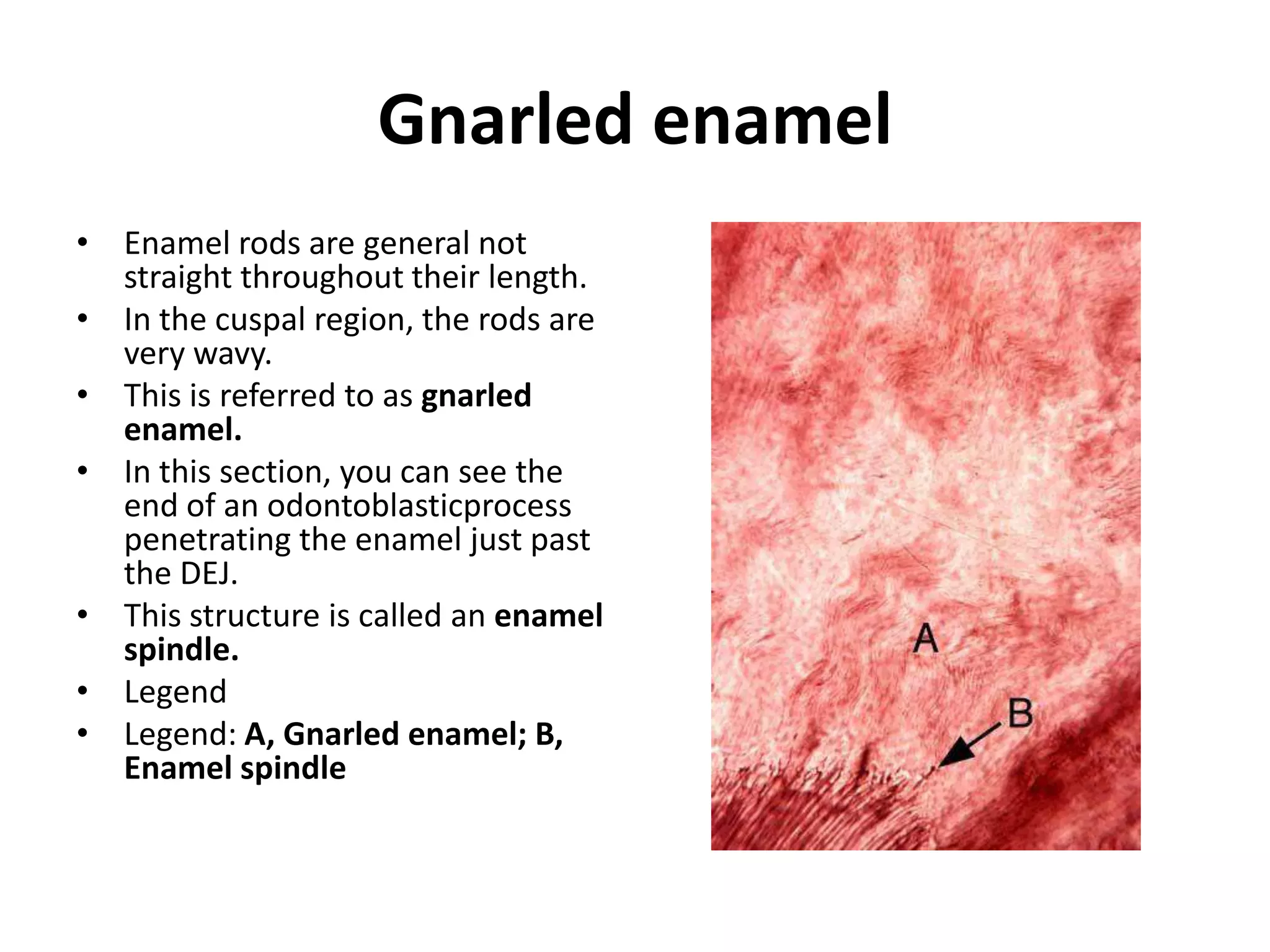 Enamel | PPTX | Dental Health | Diseases and Conditions