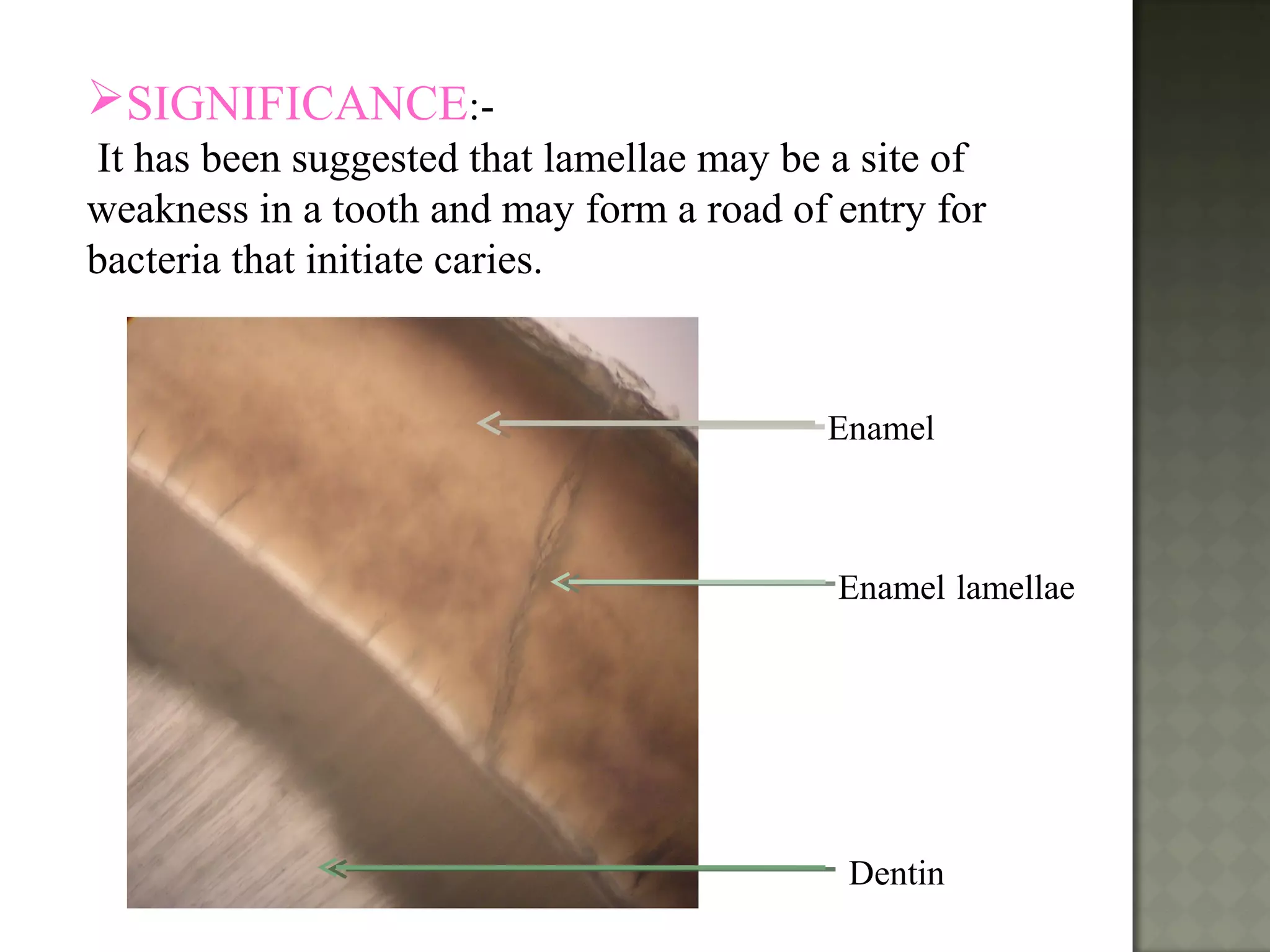 Enamel | PPT
