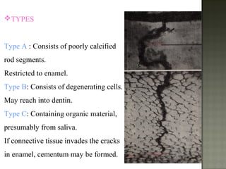 Enamel | PPT