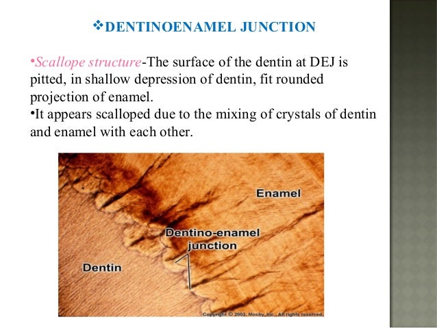 Dentinoenamel Junction