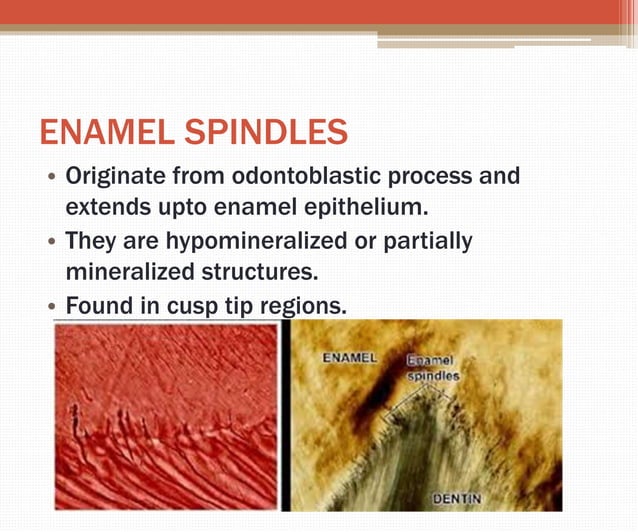 Enamel | PPTX | Dental Health | Diseases and Conditions