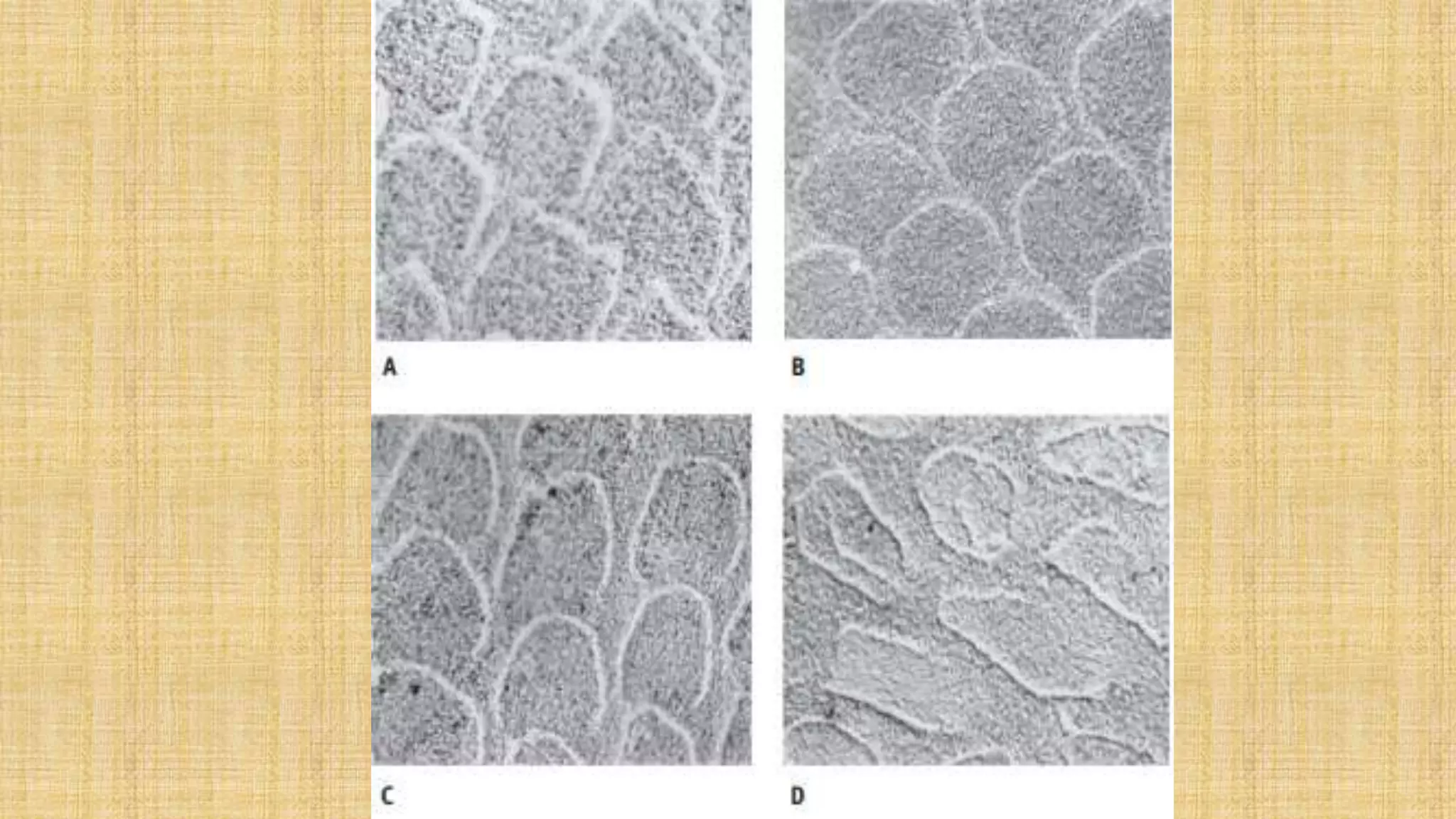 Enamel - structure and development | PPTX