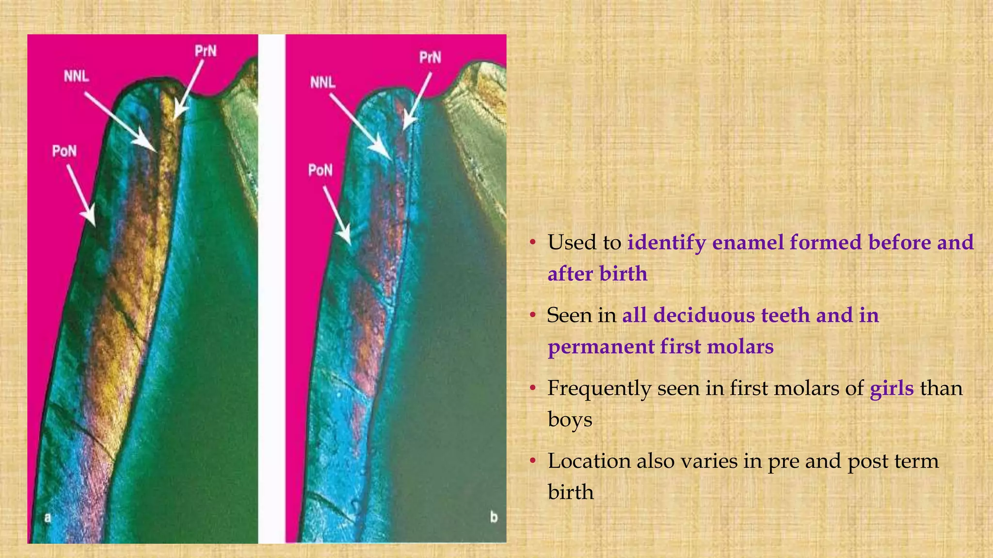 Enamel - structure and development | PPTX