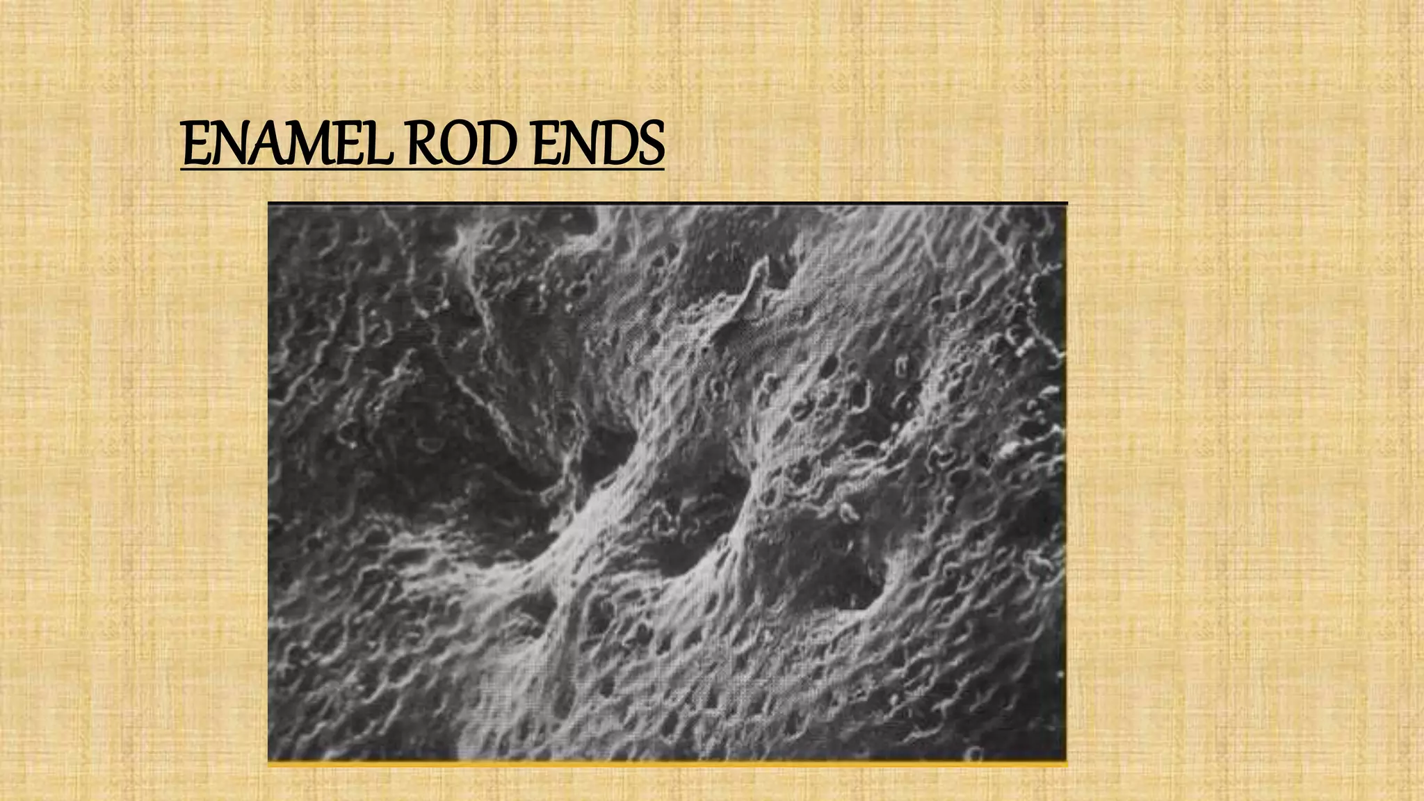 Enamel - structure and development | PPTX