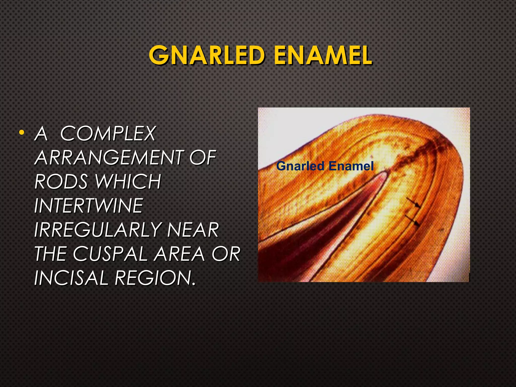 ENAMEL | PPT | Dental Health | Diseases and Conditions