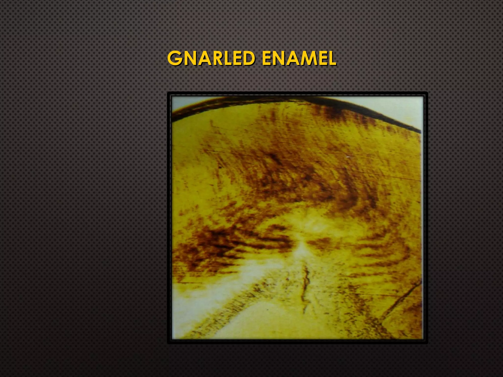 ENAMEL | PPT