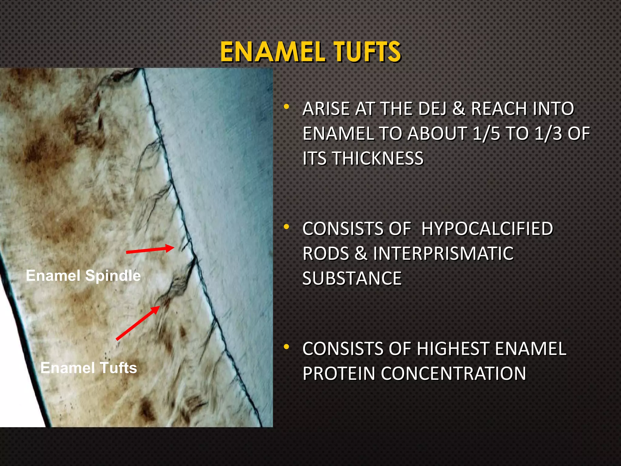 ENAMEL | PPT | Dental Health | Diseases and Conditions