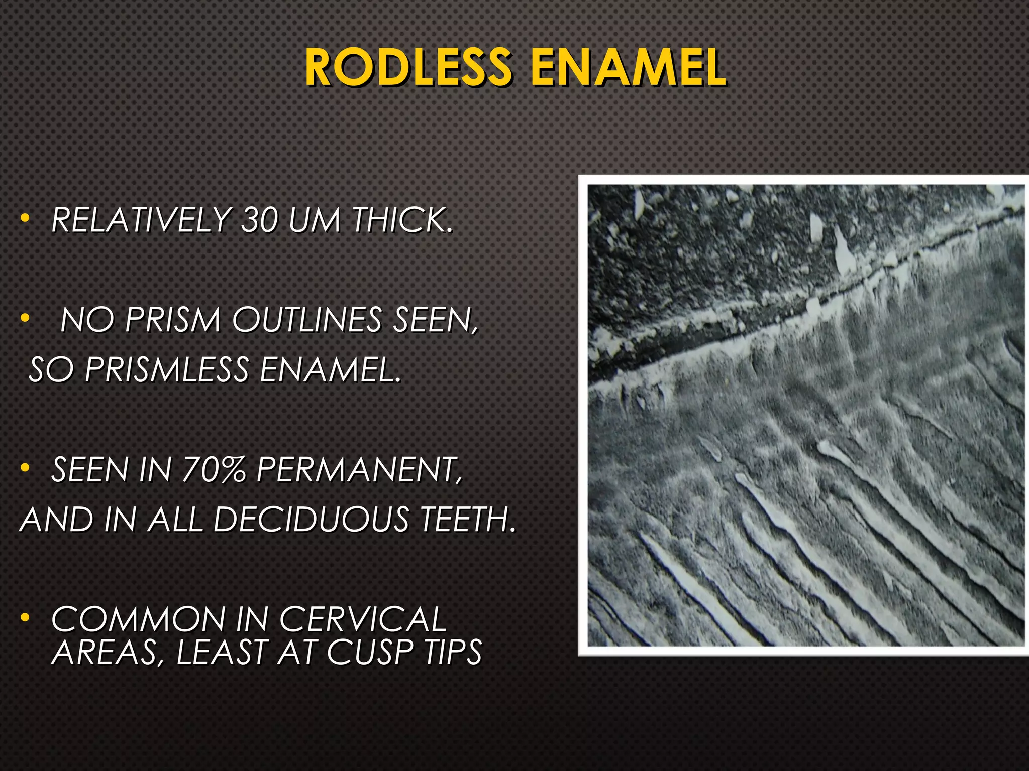 ENAMEL | PPT
