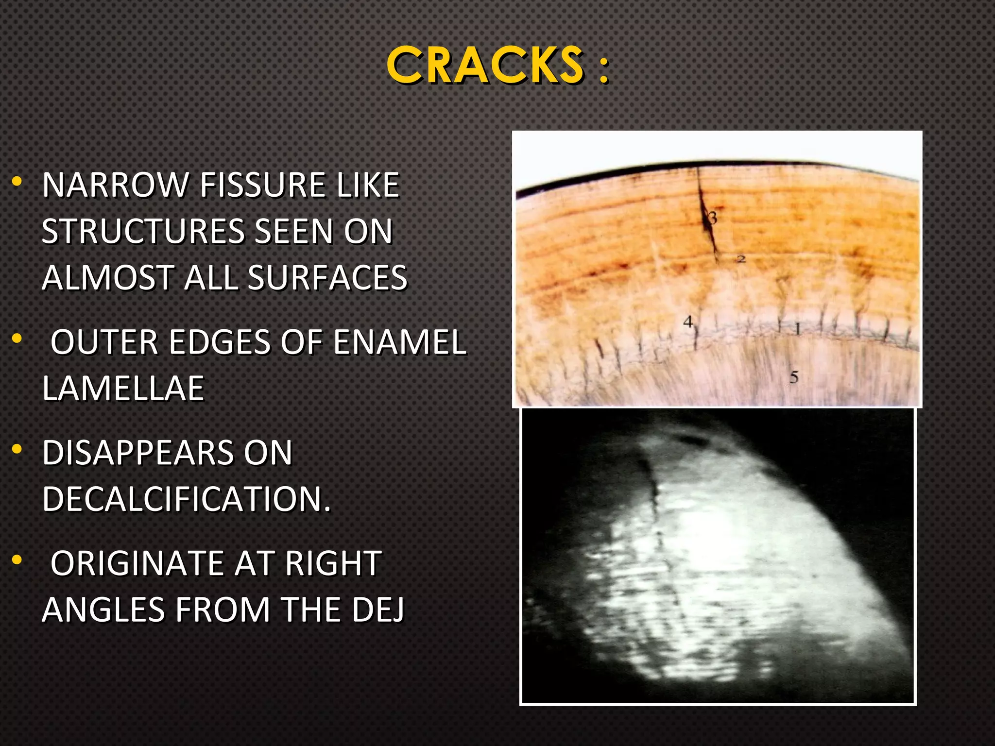 ENAMEL | PPT