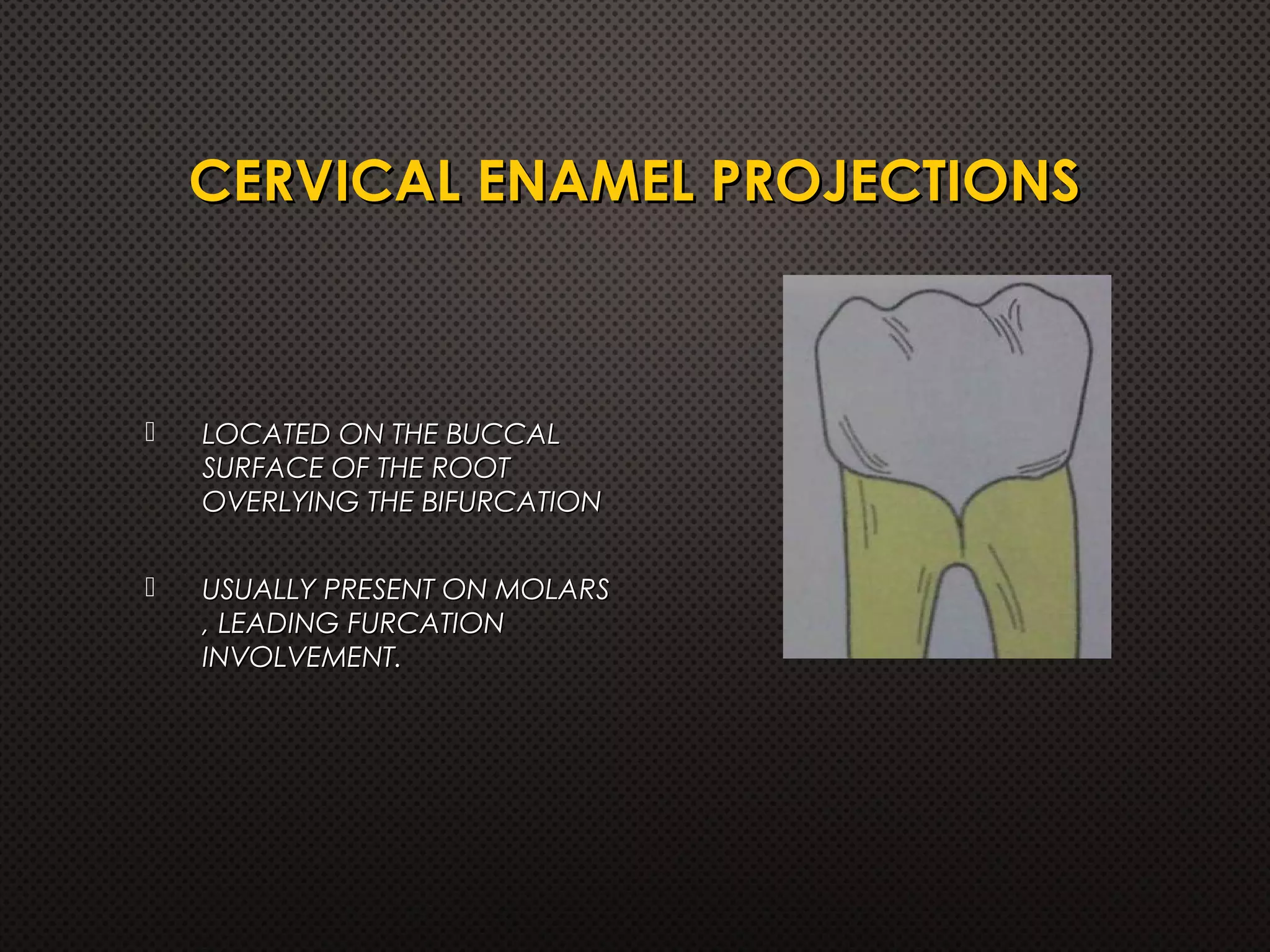 ENAMEL | PPT