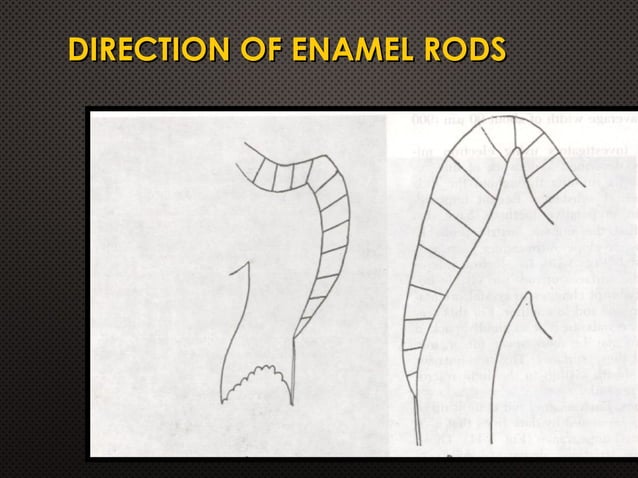 ENAMEL | PPT | Dental Health | Diseases and Conditions