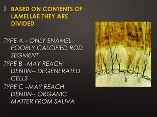 ENAMEL | PPT