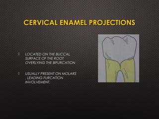 Cervical Enamel Projection