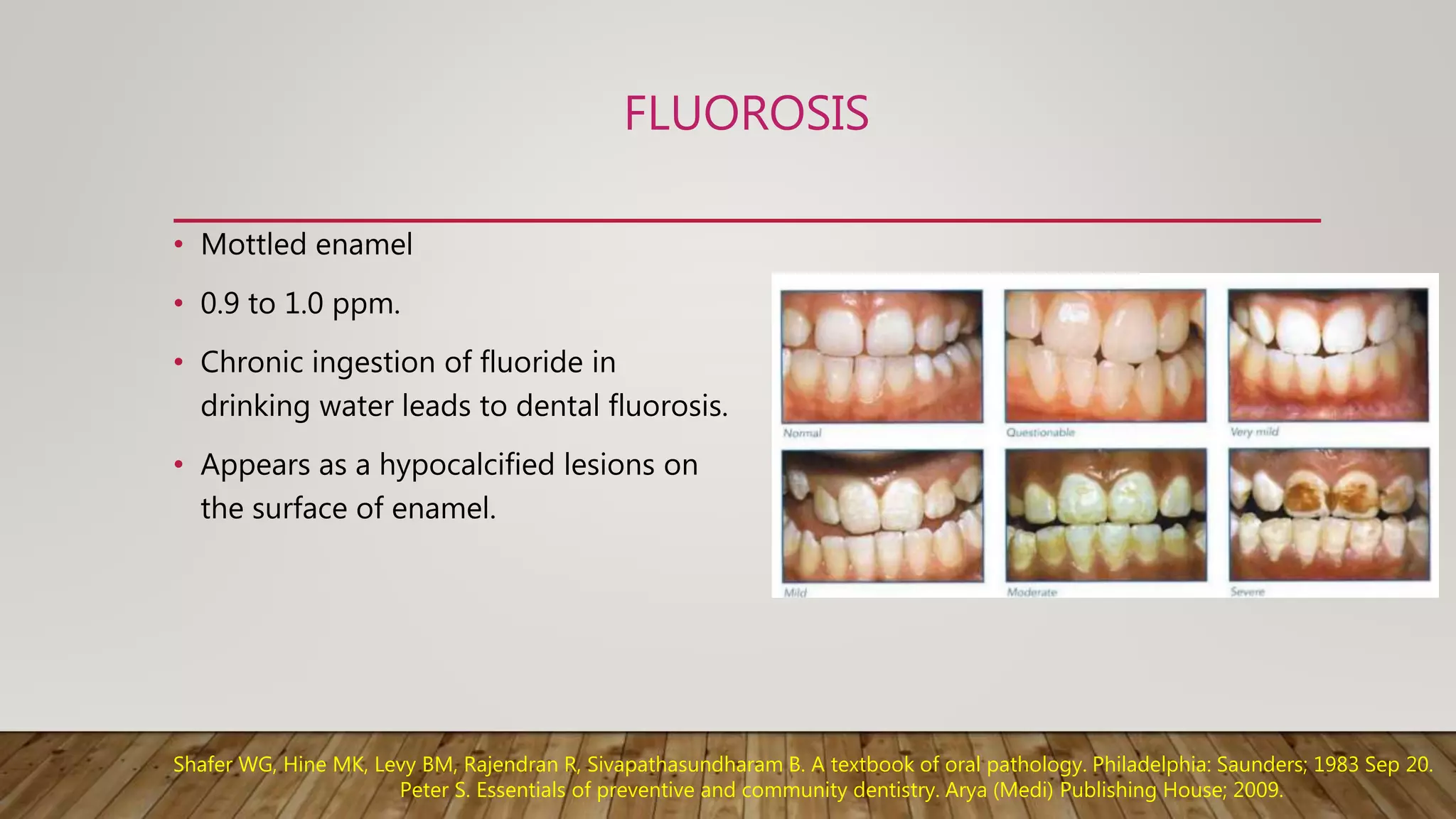 Enamel CONSERVATIVE DENTISTRY AND ENDODONTICS | PPTX