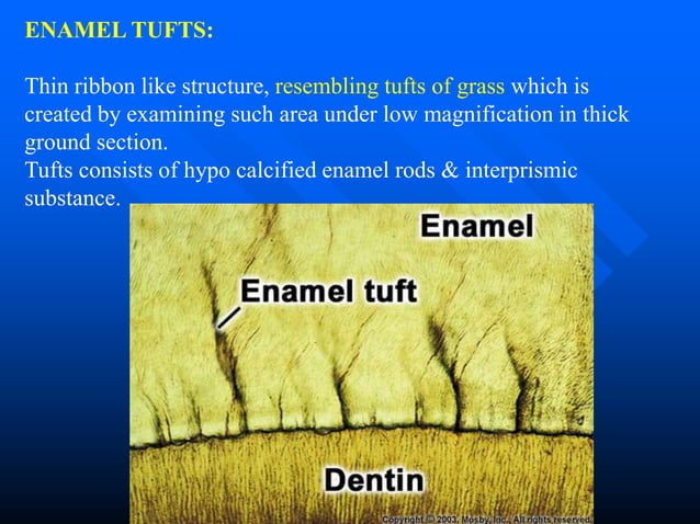 TOOTH ENAMEL - HISTOPATHOLOGY FOR STUDENTS | PPT