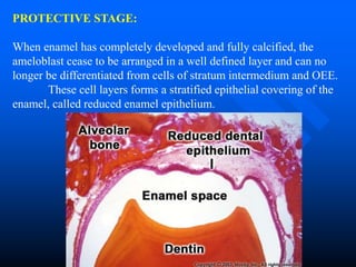 TOOTH ENAMEL - HISTOPATHOLOGY FOR STUDENTS | PPT