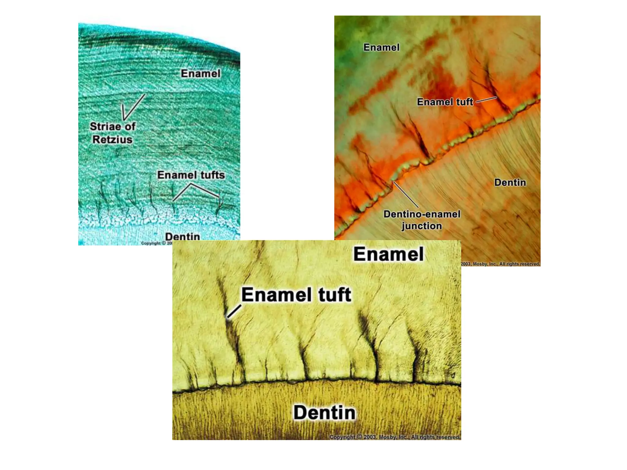 Final enamel Powerpoint including morphological and histological features of Enamel | PPT