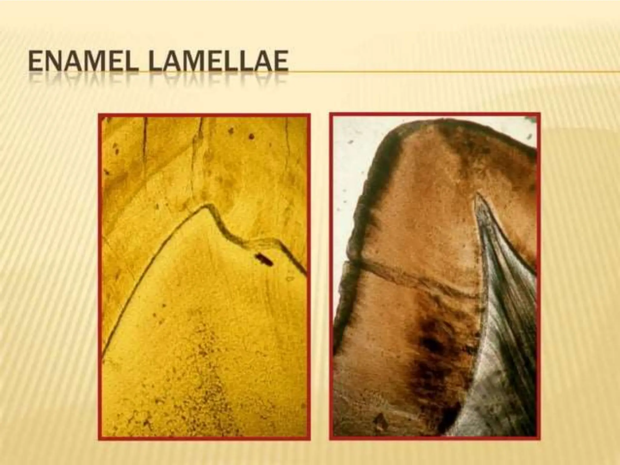 ENAMEL - ORAL HISTOLOGY FOR BDS STUDENTS | PPTX