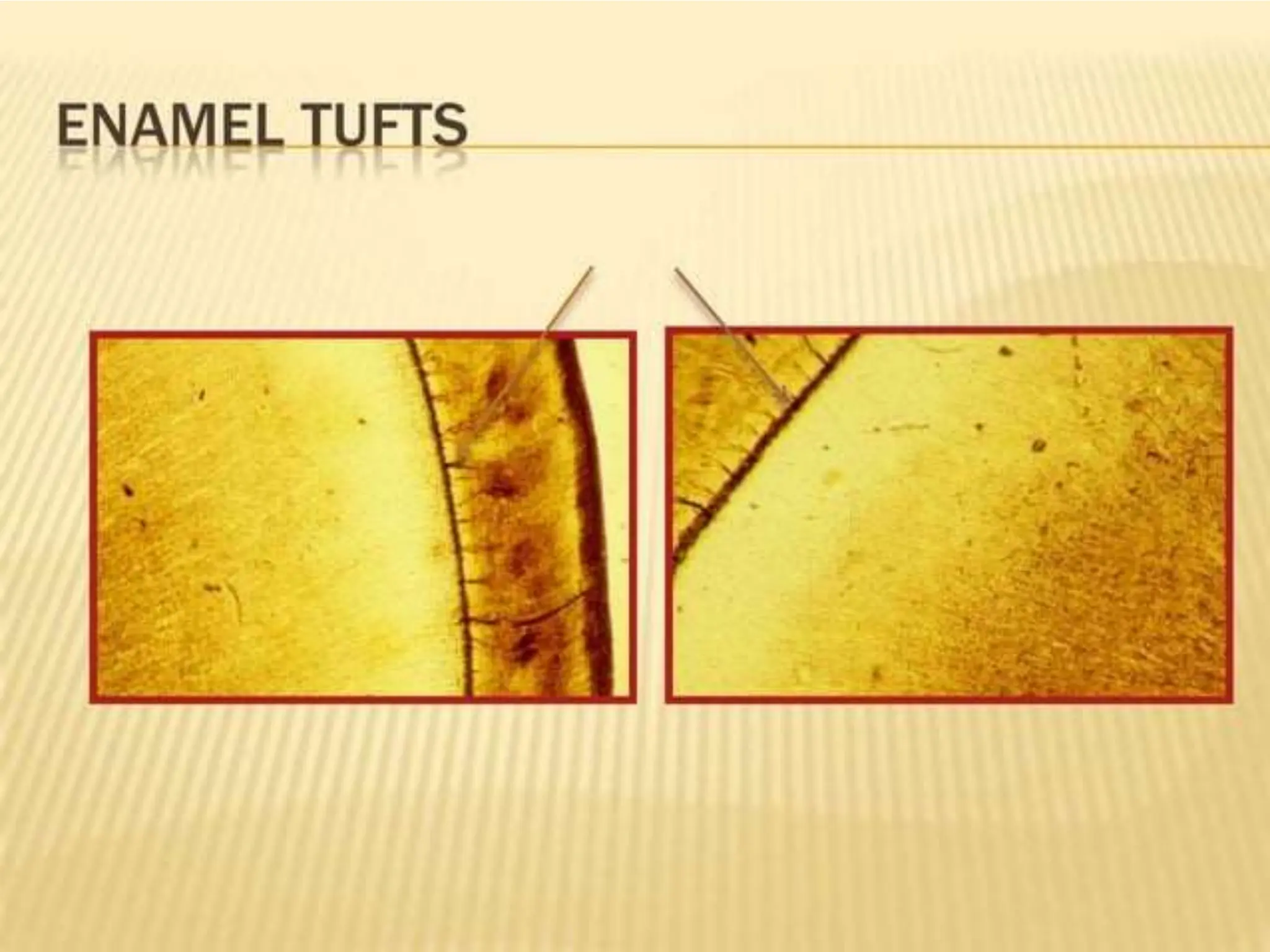 ENAMEL - ORAL HISTOLOGY FOR BDS STUDENTS | PPTX