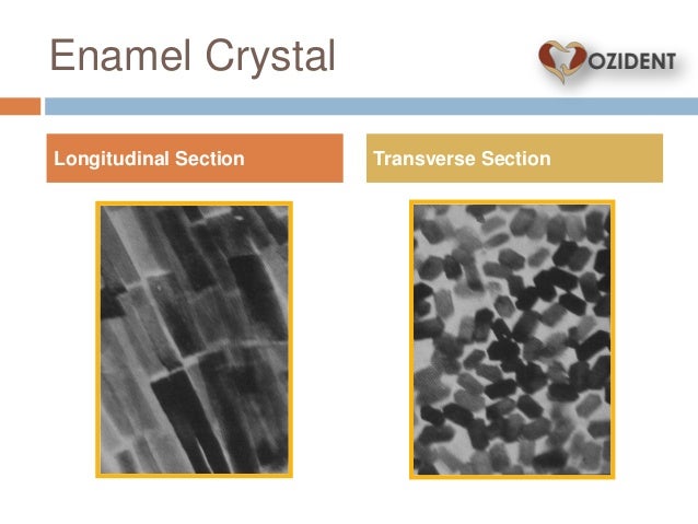 Dental Anatomy: Enamel