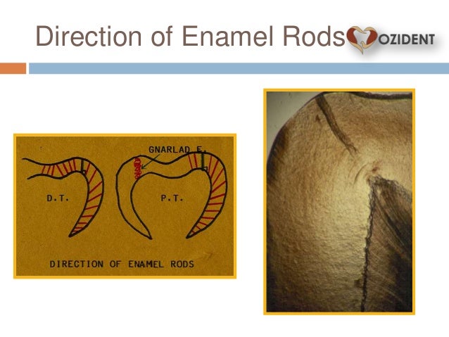 Dental Anatomy: Enamel