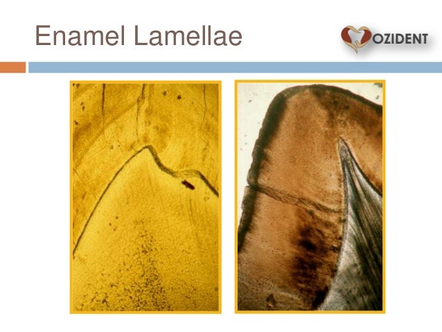 Dental Anatomy: Enamel