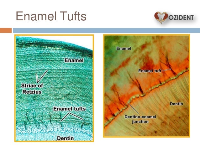 Dental Anatomy: Enamel