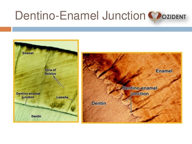 Dentinoenamel Junction