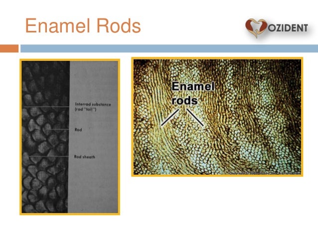 Dental Anatomy: Enamel