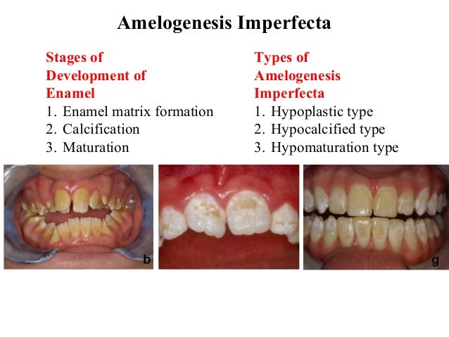 Enamel 1 (Abdullah Akbar)