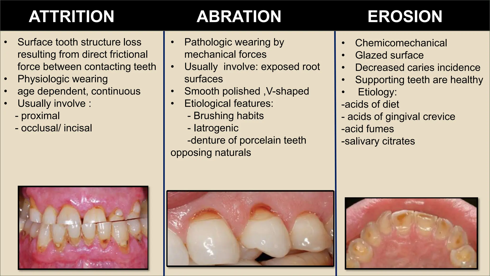 Enamel _ Ashel _ up . pptx | PPTX